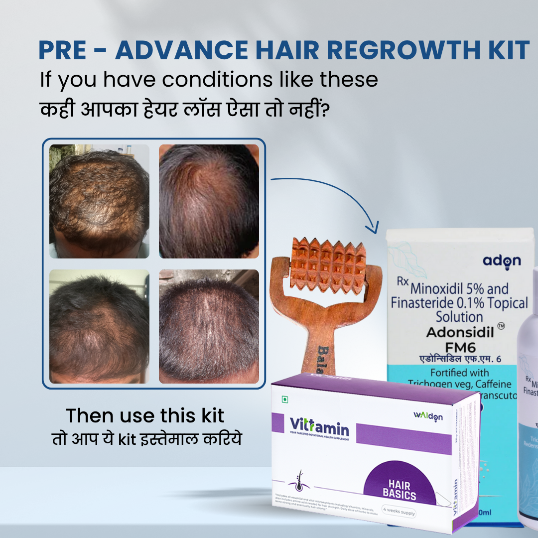 Essential ( Pre - Advance ) Hair Regrowth Kit – Waidon